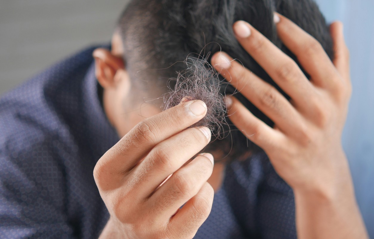 Normal Male Hairline: Patterns, Changes, and Expert Insights